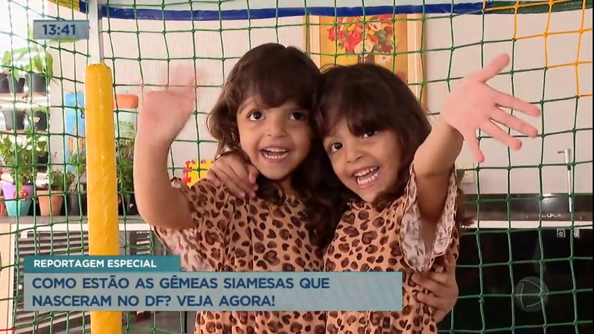 Família conta como estão gêmeas siamesas nascidas no DF - Brasília - R7 ...
