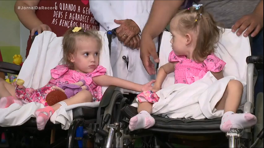 Gêmeas siamesas separadas em cirurgia recebem alta - Notícias - R7 JR na TV