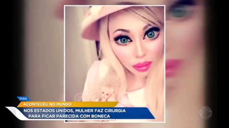 Americana passa por cirurgia nos olhos para se parecer com a Barbie ...